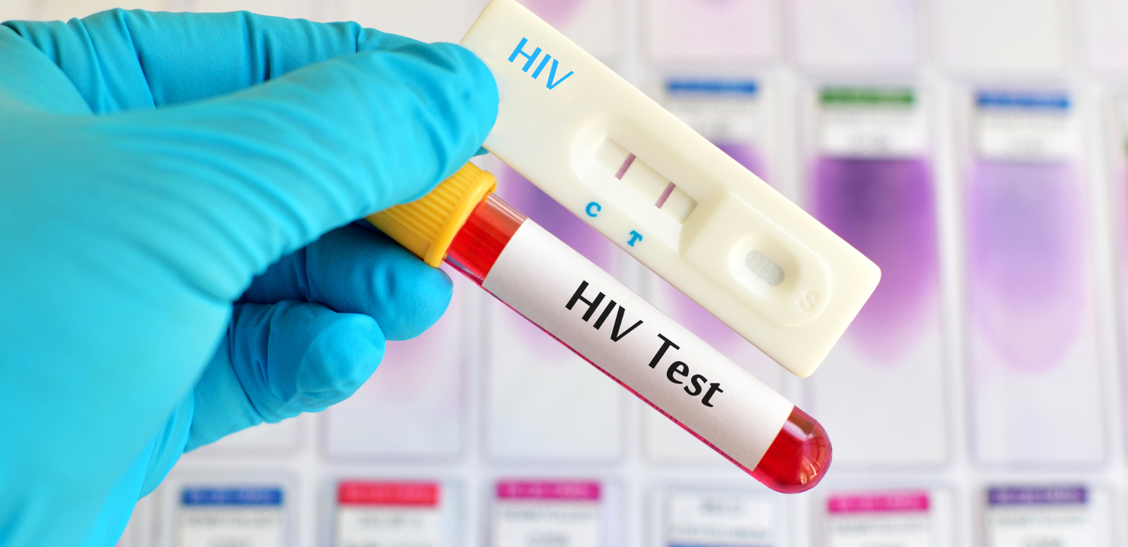 Diferencias entre VIH y SIDA: la importancia del diagnóstico precoz para alcanzar una carga ...